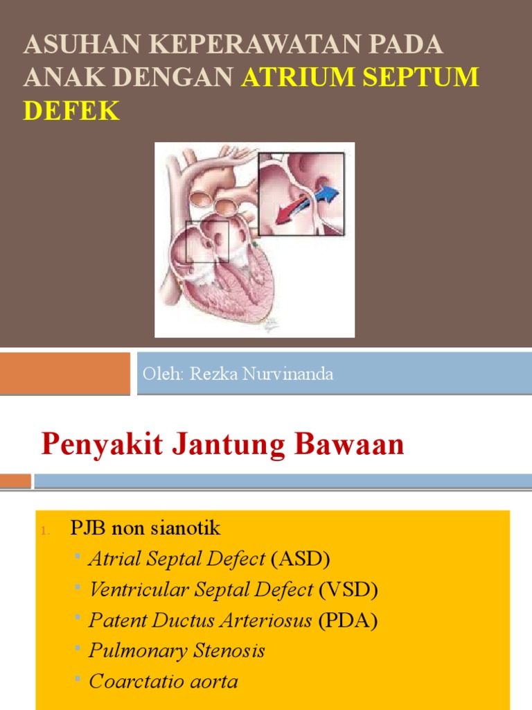 ASD Dan VSD | PDF