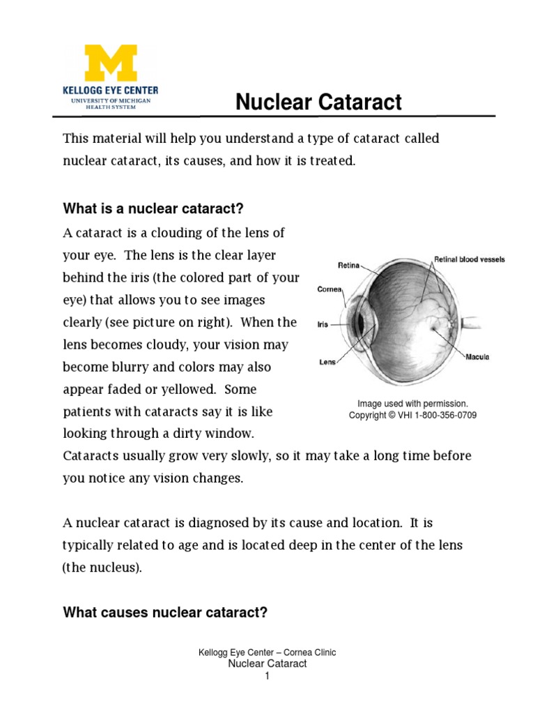 What Is A Nuclear Cataract? | PDF | Cataract | Vision