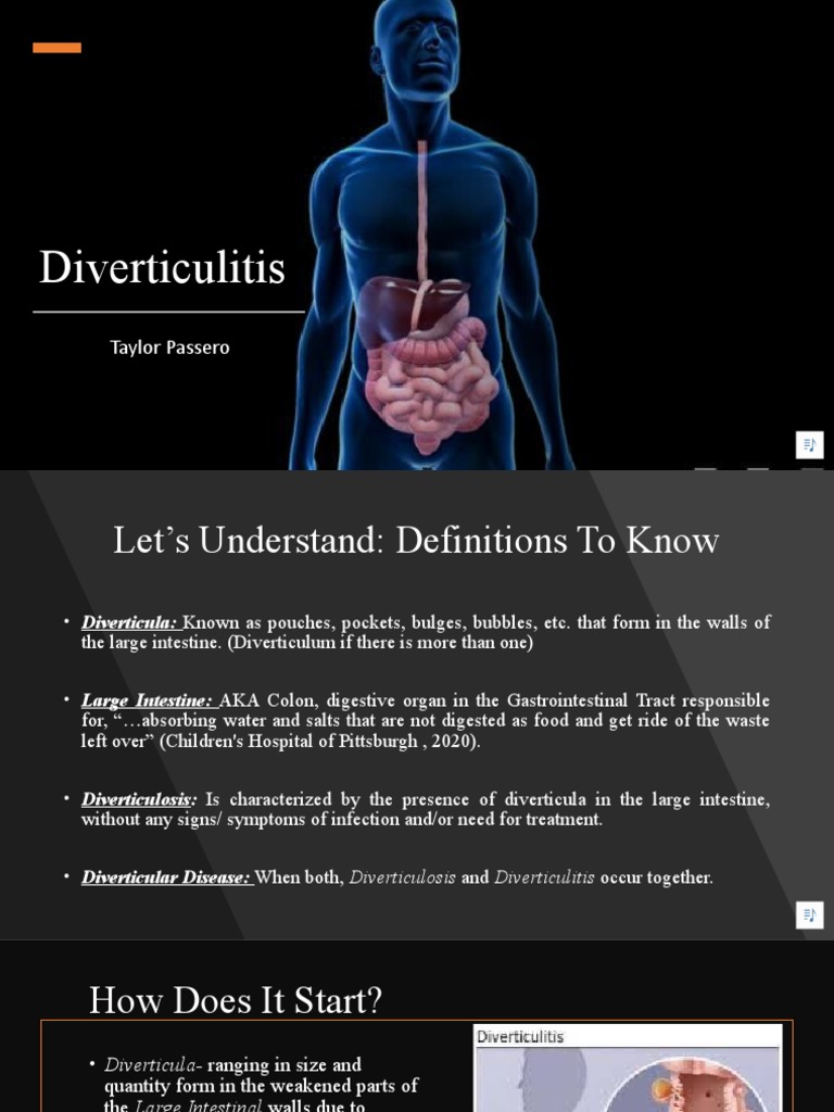 Understanding Diverticulitis and Care | PDF | Rtt | Health Sciences
