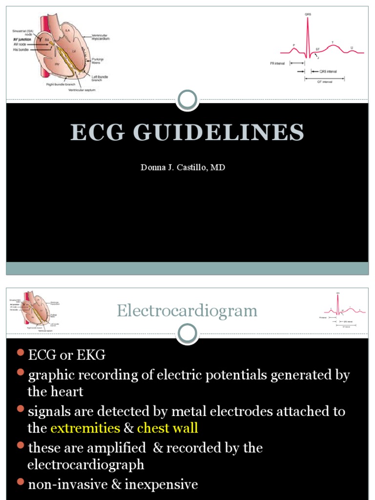 Ecg Guidelines: Donna J. Castillo, MD | PDF | Electrocardiography ...