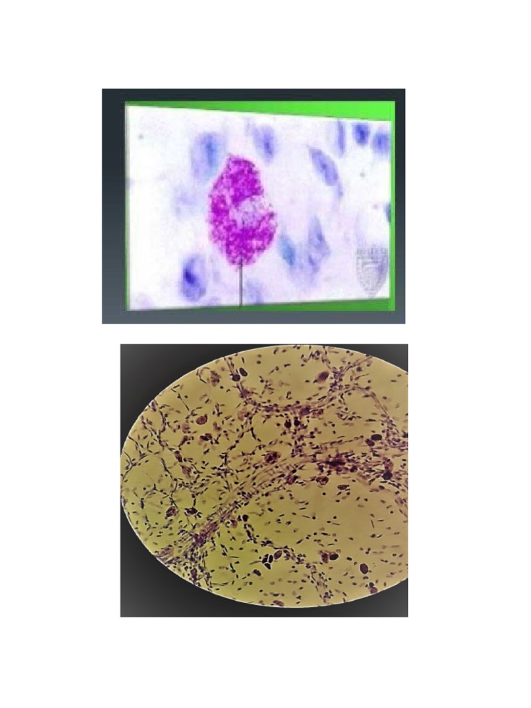 Celulas Cebadas | PDF