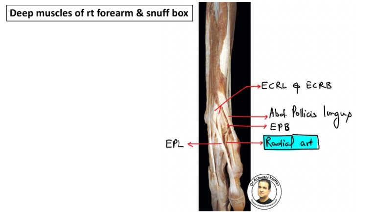 Deep Muscles of RT Forearm & Snuff Box | PDF