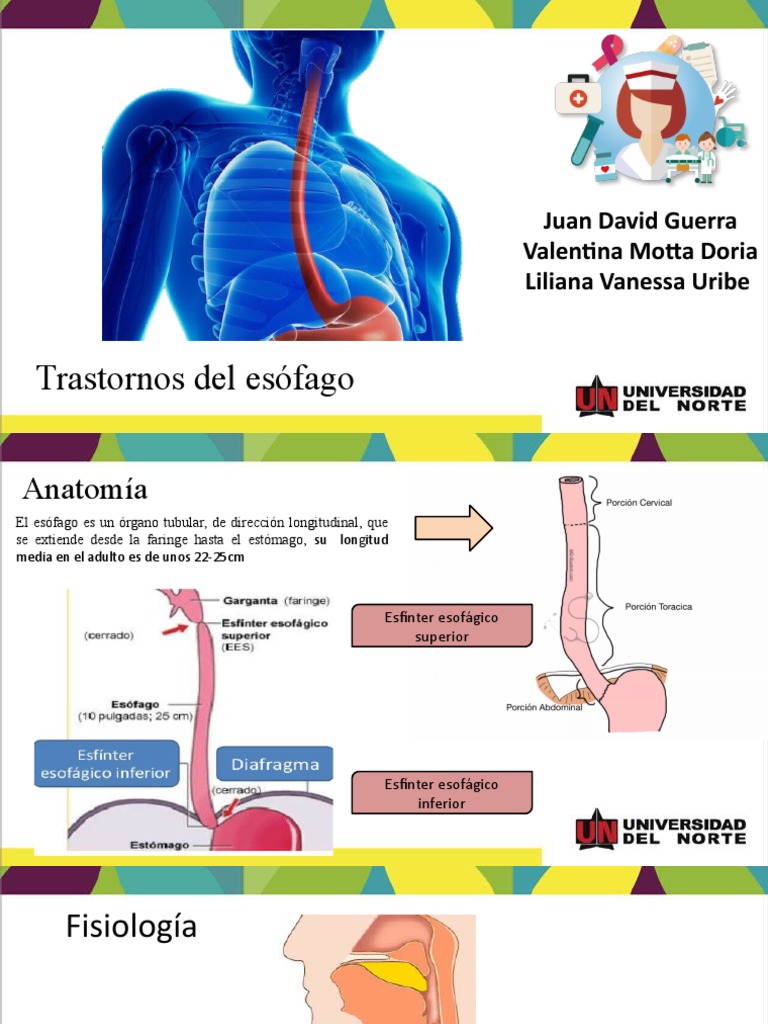 Seminario de Trastornos Del Esofago | PDF | La enfermedad por reflujo ...