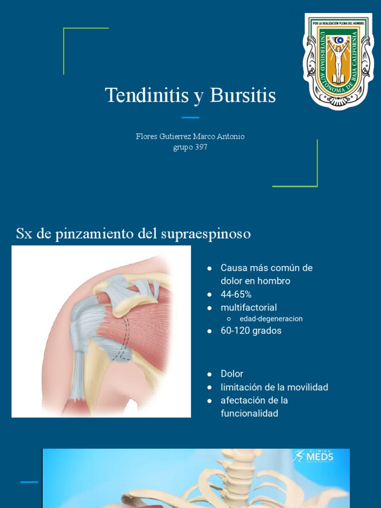 Tendinitis y Bursitis | PDF | Mano | Sistema musculoesquelético