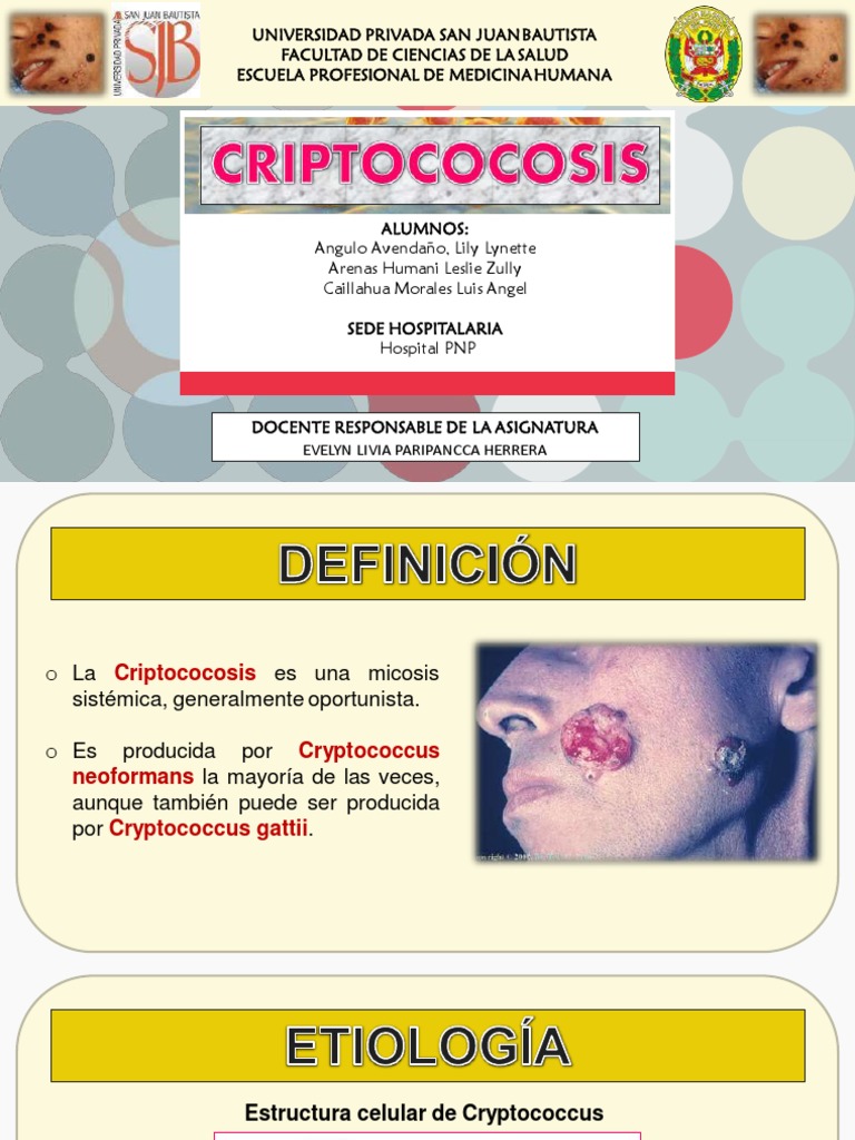 Criptococosis PDF | PDF