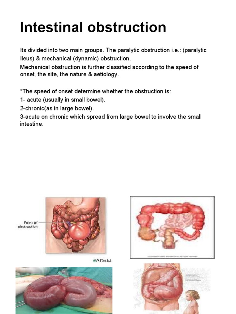 Intestinal Obstruction | PDF | Gastrointestinal Tract | Gastroenterology