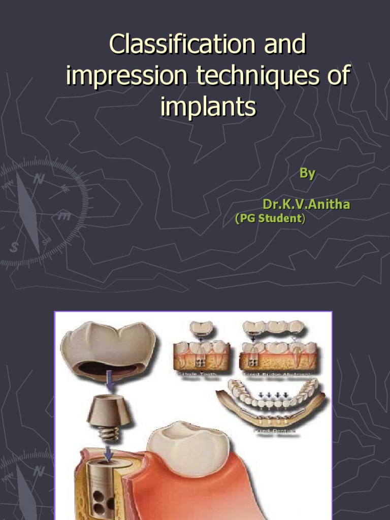 Implant Classification and Impression Techniques | PDF | Dental Implant ...