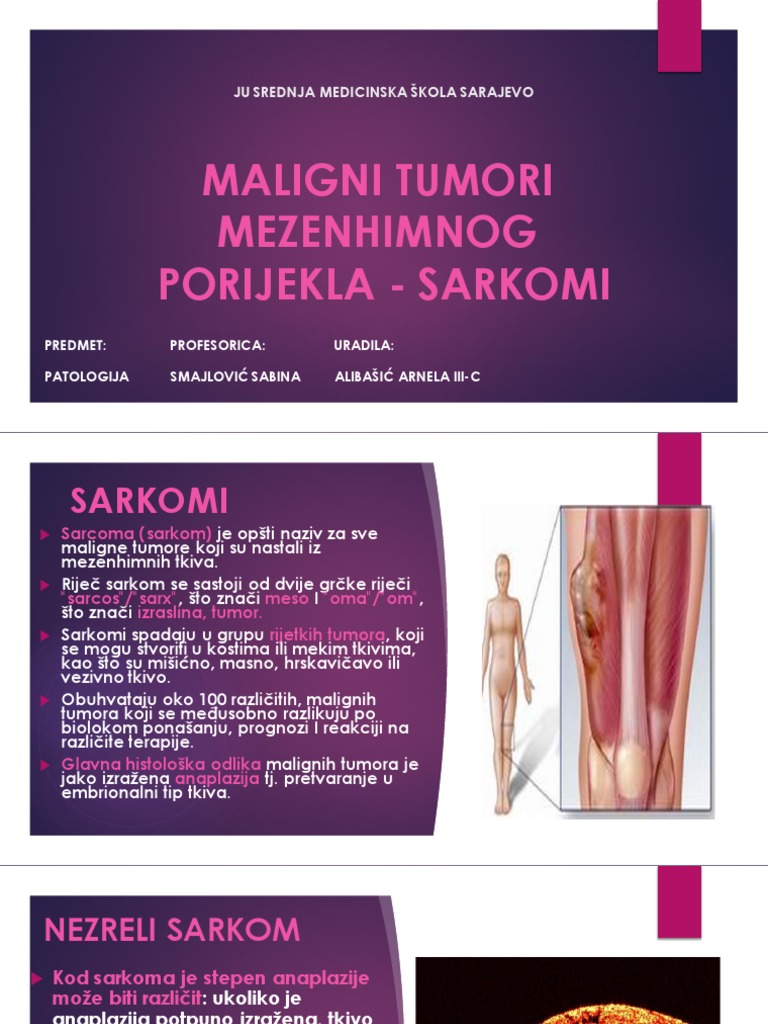 Sarkomi 1 | PDF