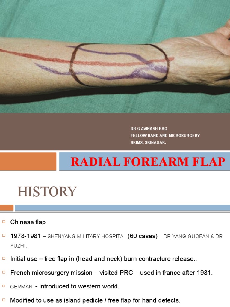 Radial Forearm Flap | PDF | Anatomical Terms Of Location | Hand