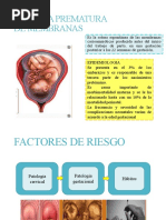 Distocia Funicular: Definición y Evaluación | PDF | Parto | Feto