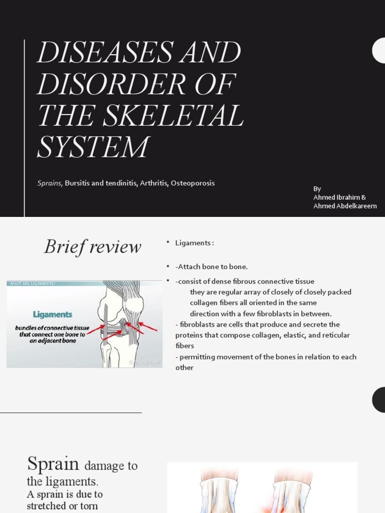 Diseases and Disorder of The Skeletal System: Sprains, Bursitis and ...