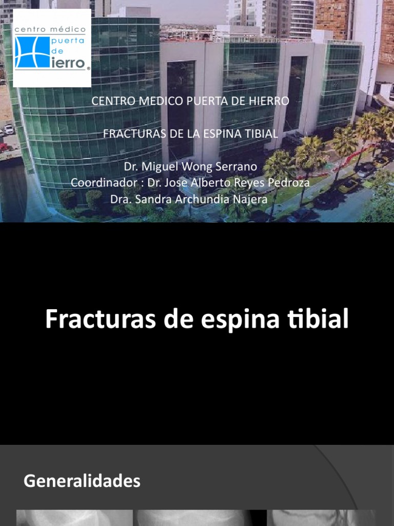 FX Espina Tibial | PDF | Rodilla | Sistema musculoesquelético