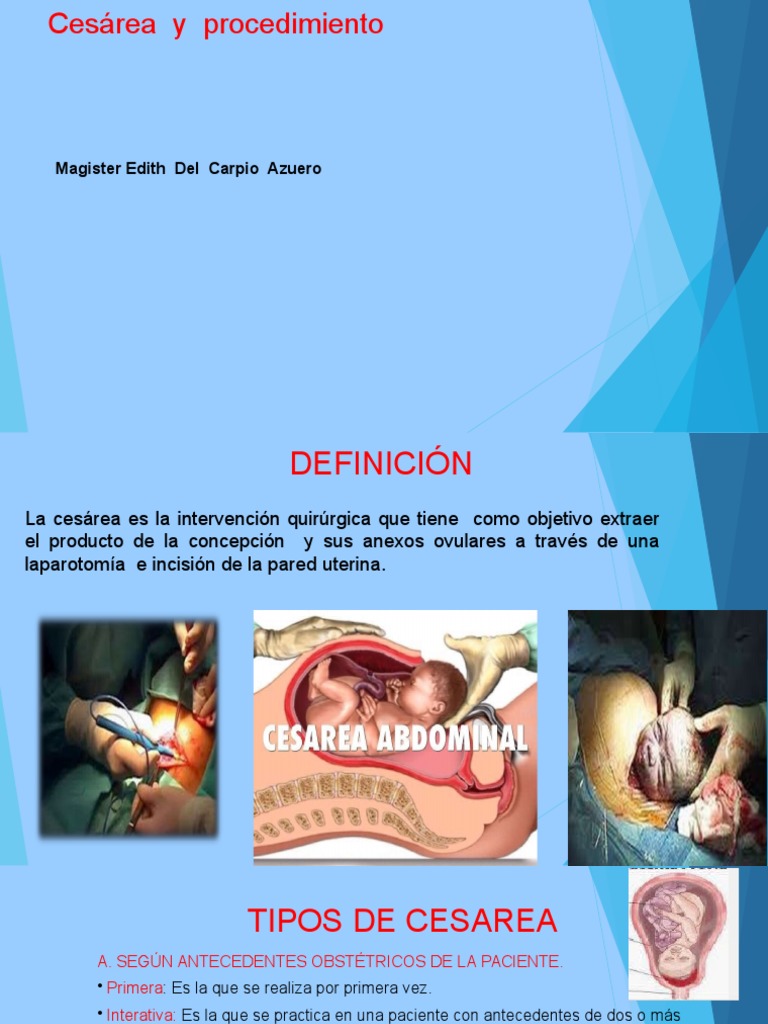 Tipos y técnica de cesárea | PDF | Seccion de cesárea | Parto