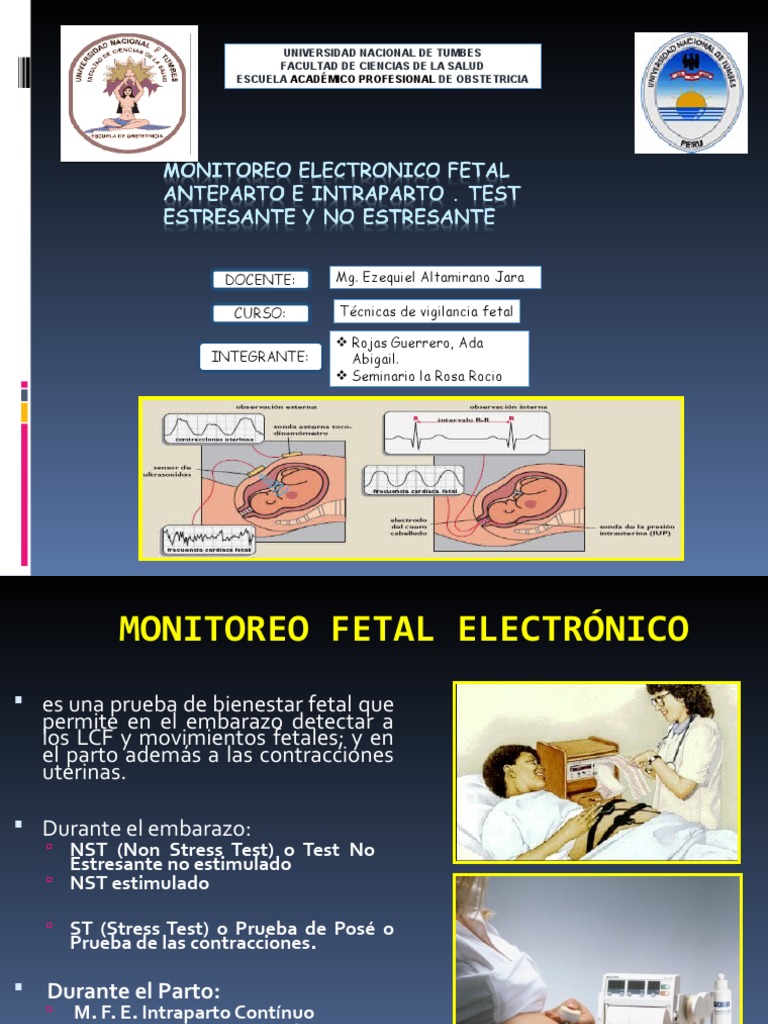 Monitoreo Fetal Intraparto y Anteparto | PDF | Parto | Salud maternal