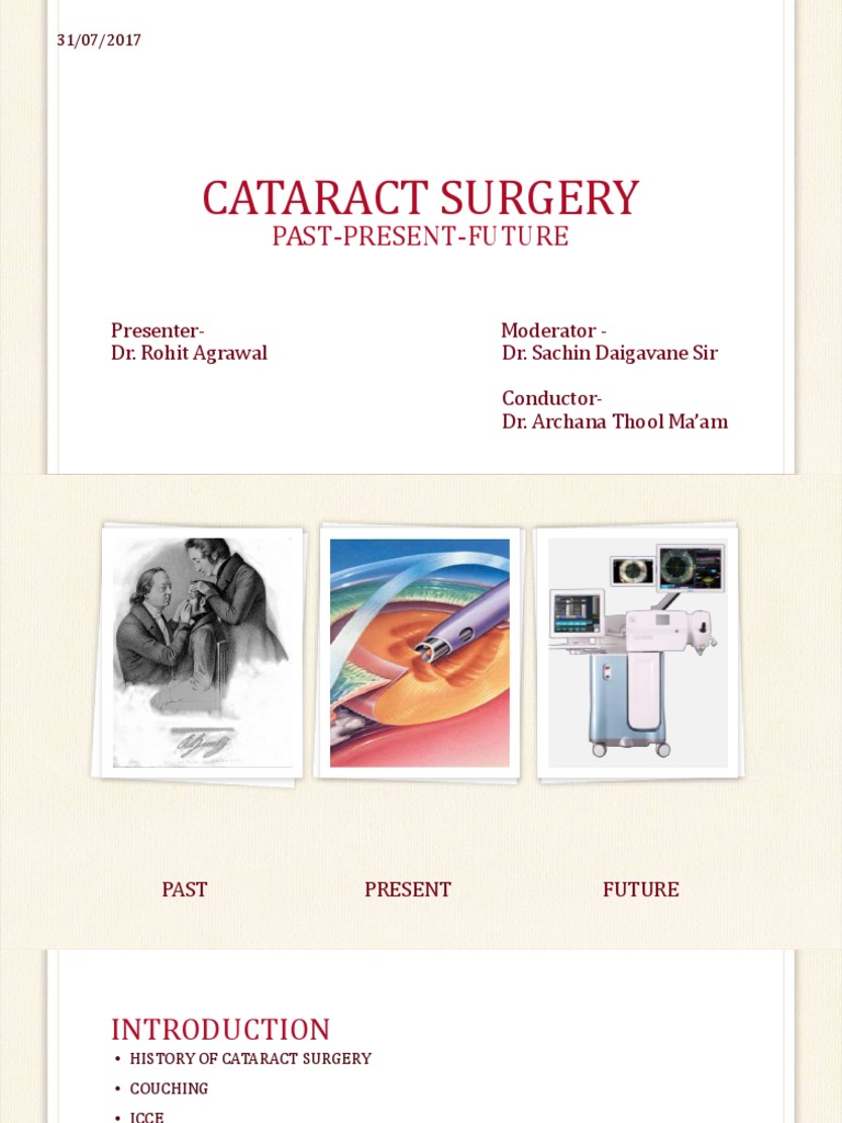 Cataract Surgery: Past-Present-Future | PDF | Surgery | Facial Features