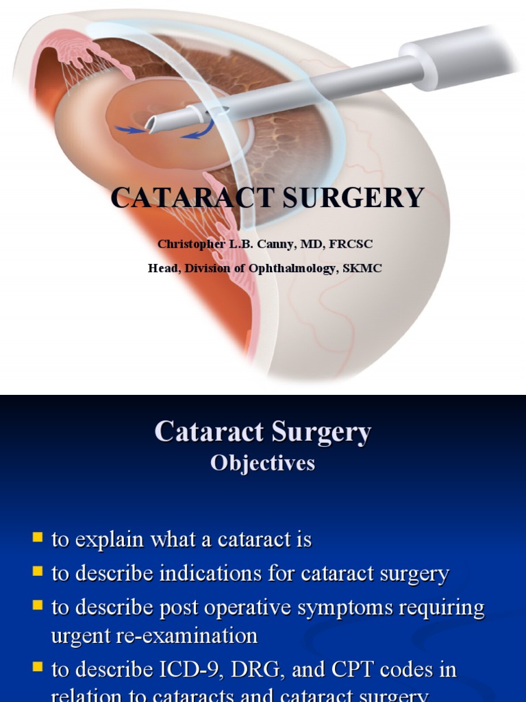 Cataract Surgery and Coding | PDF | Cataract | Visual System