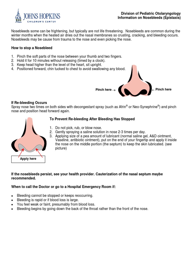 Nosebleed Handout PDF | PDF