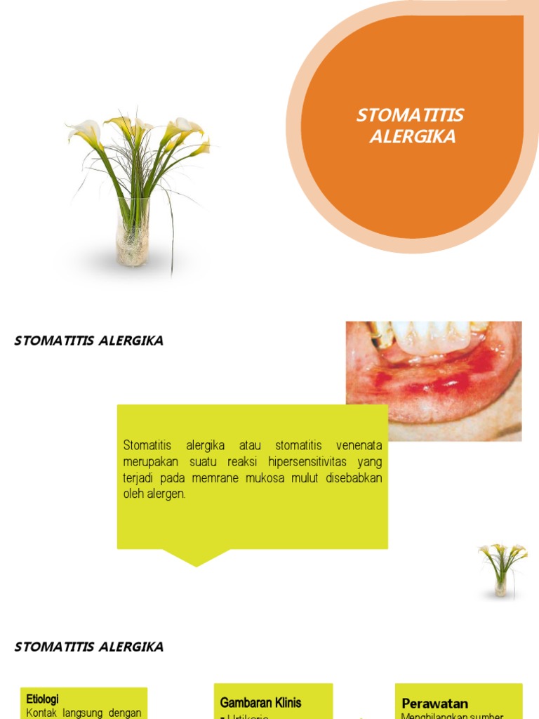 Om Stomatitis | PDF | Kesehatan Holistik | Sains & Matematika