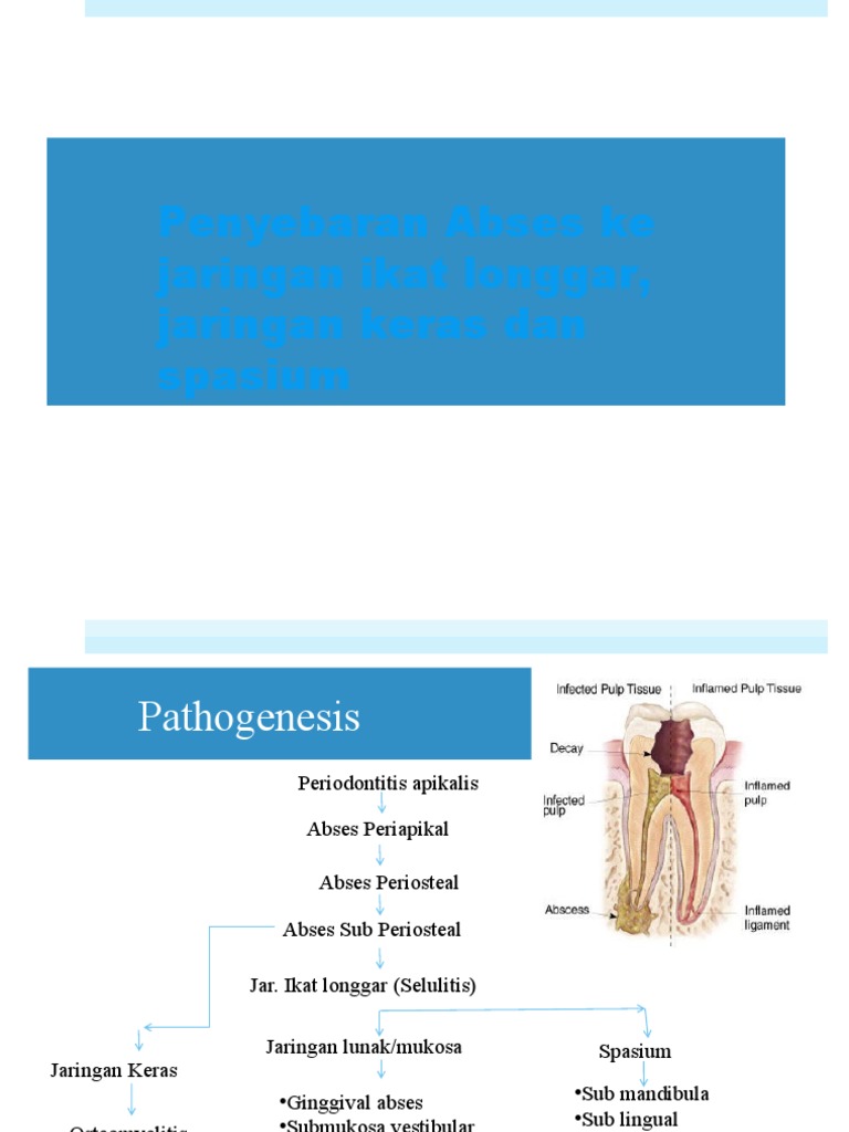 Penyebaran Abses | PDF