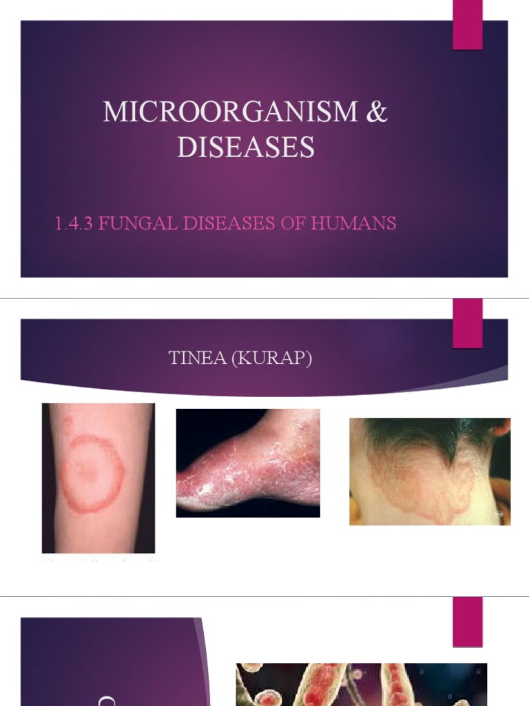 Microorganism & Diseases: 1.4.3 Fungal Diseases of Humans | PDF