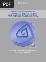 Step-by-Step FESS Surgical Guide | PDF | Human Nose | Human Head And Neck