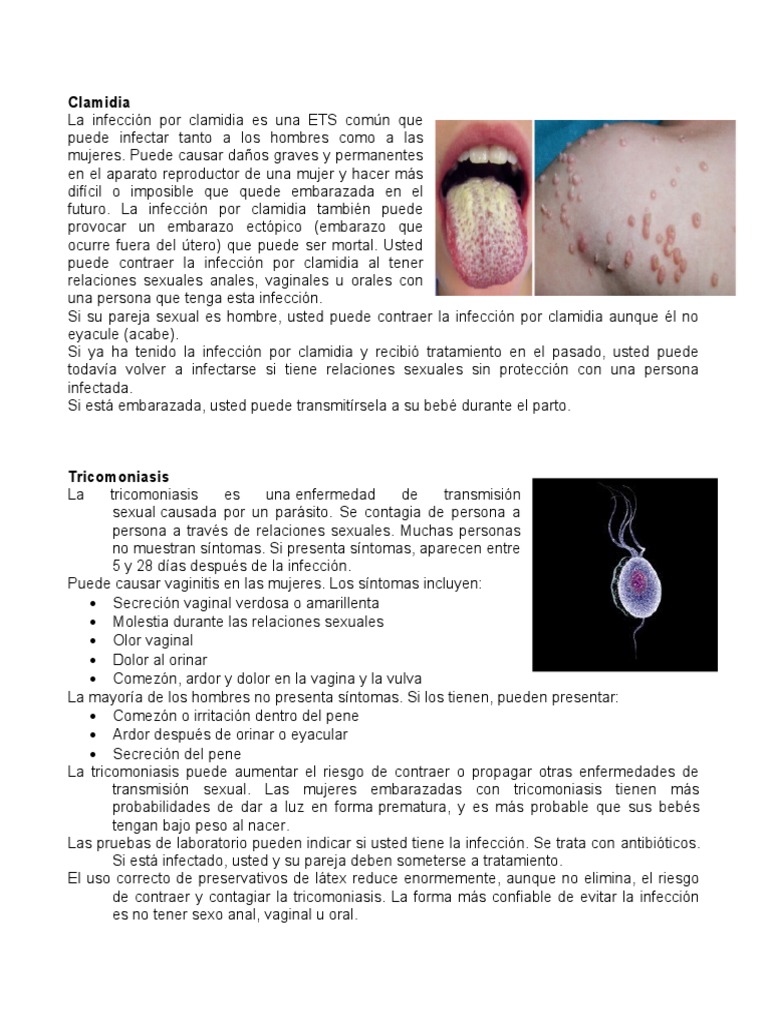 Clamidia y Tricomoniasis: Riesgos y Prevención | PDF | Condón ...