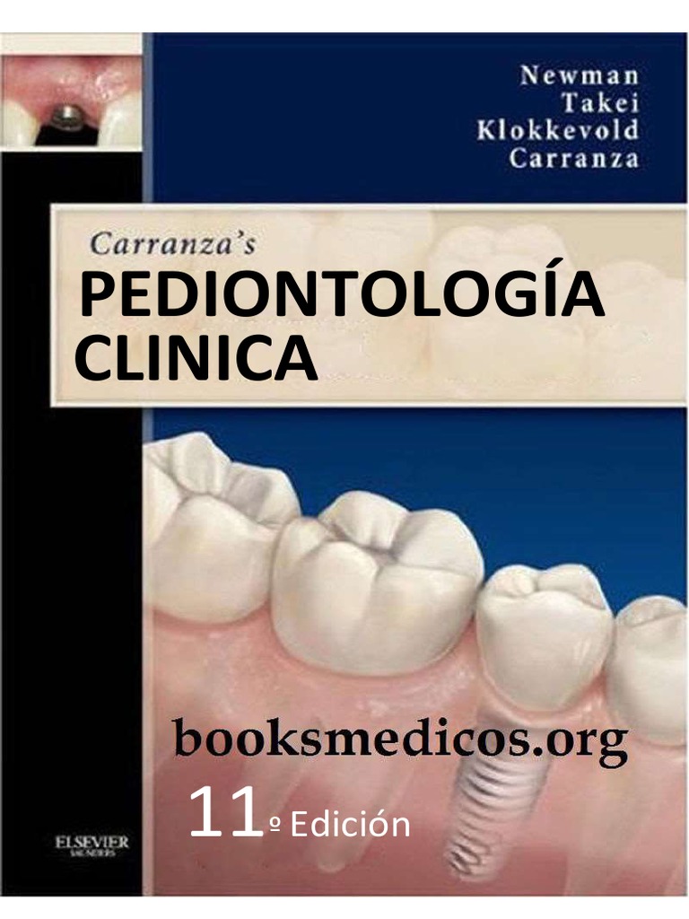 Carranza Perio 11 Ed Ici On | PDF | Universidad de California | Odontología