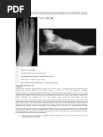 EMRA SportsMedicine Splint Guide | PDF | Thumb | Hand