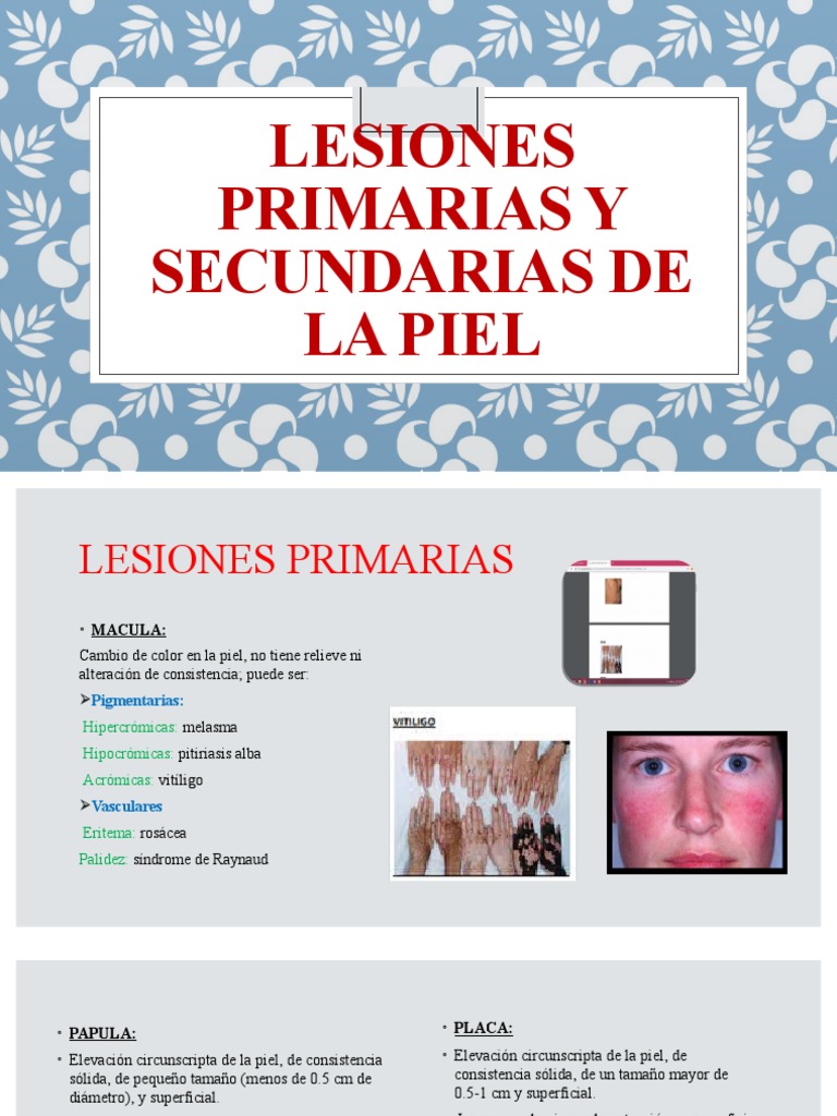 Lesiones Primarias y Secundarias de La Piel | Descargar gratis PDF ...