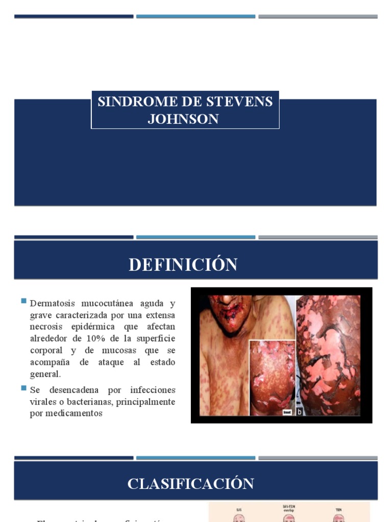 SX Stevens Johnson | PDF | Medicamentos con receta | Diagnostico medico