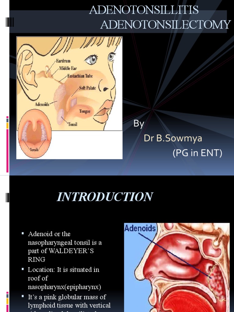 Adenotonsillectomy Overview by Dr. Sowmya | PDF | Human Head And Neck ...