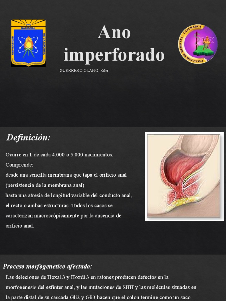 Ano Imperforado | PDF