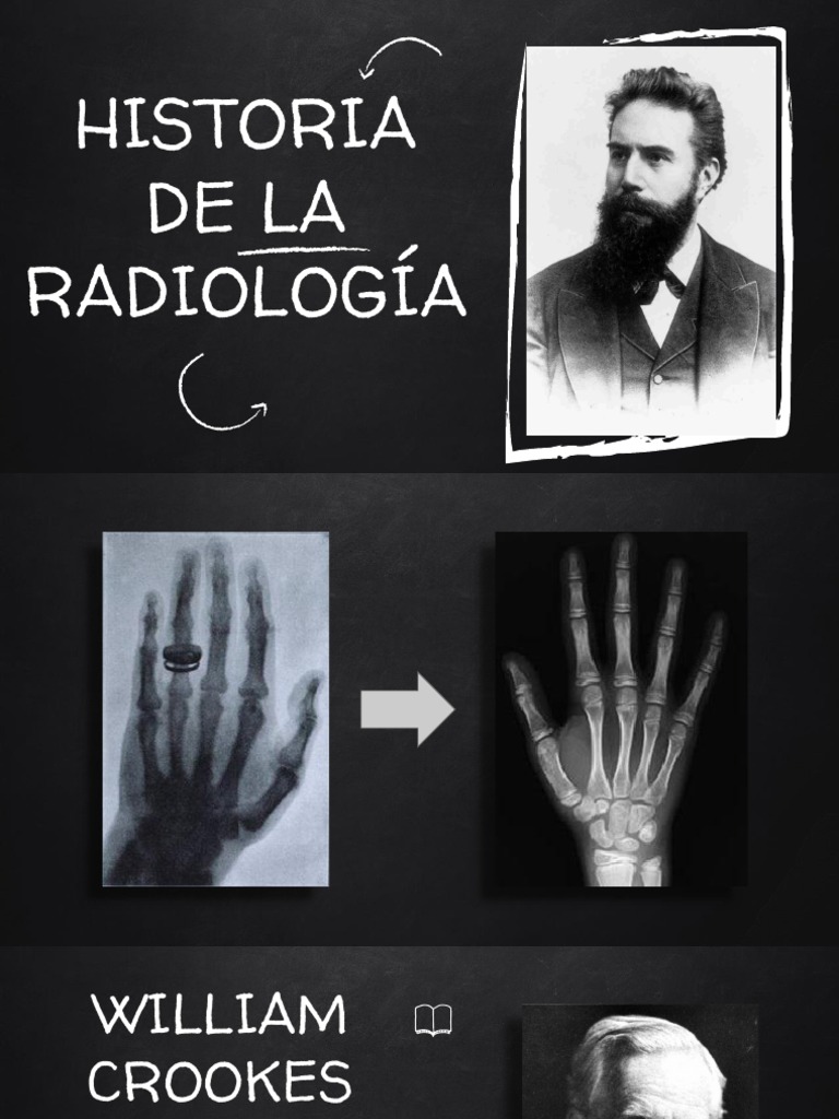 01 Historia de La Radiologia | PDF | Nikola Tesla | Marie Curie