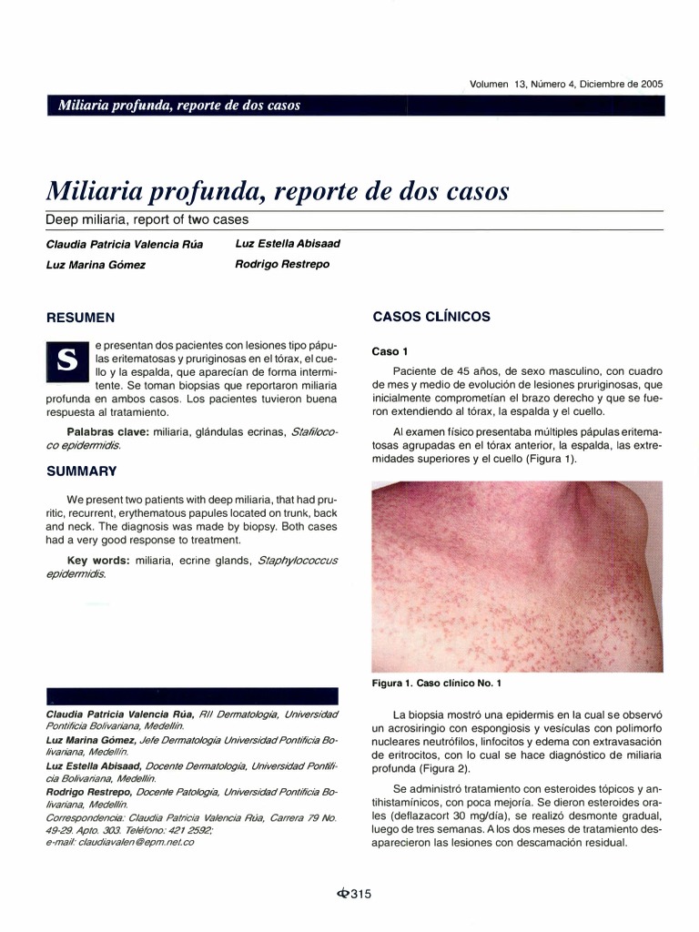 Tratamiento de Miliaria Profunda en Adultos | PDF | Sistema ...