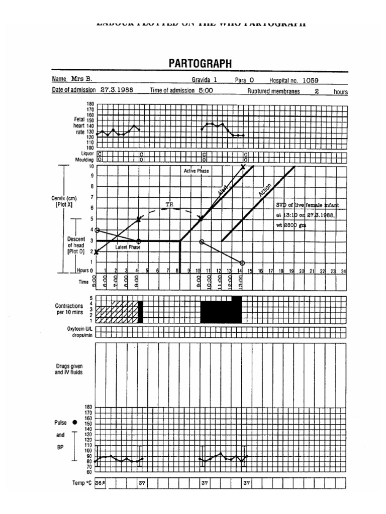 Figure 1.1: Labour plotted on the WHO Partograph for patient Mrs. B ...