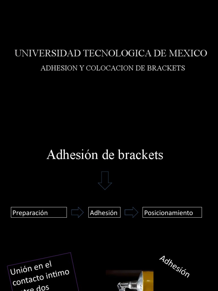 Adhesión y colocación de brackets en ortodoncia | PDF | Adhesión ...
