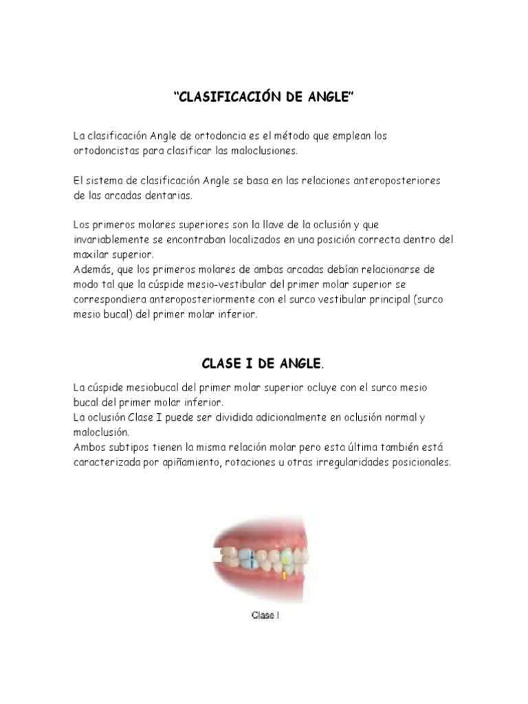 Clasificación de Angle en Ortodoncia | PDF | Boca | Ramas de Odontología