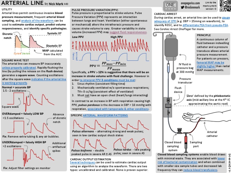 Pulse Pressure Variation in ICU Monitoring | PDF | Blood Pressure | Pulse