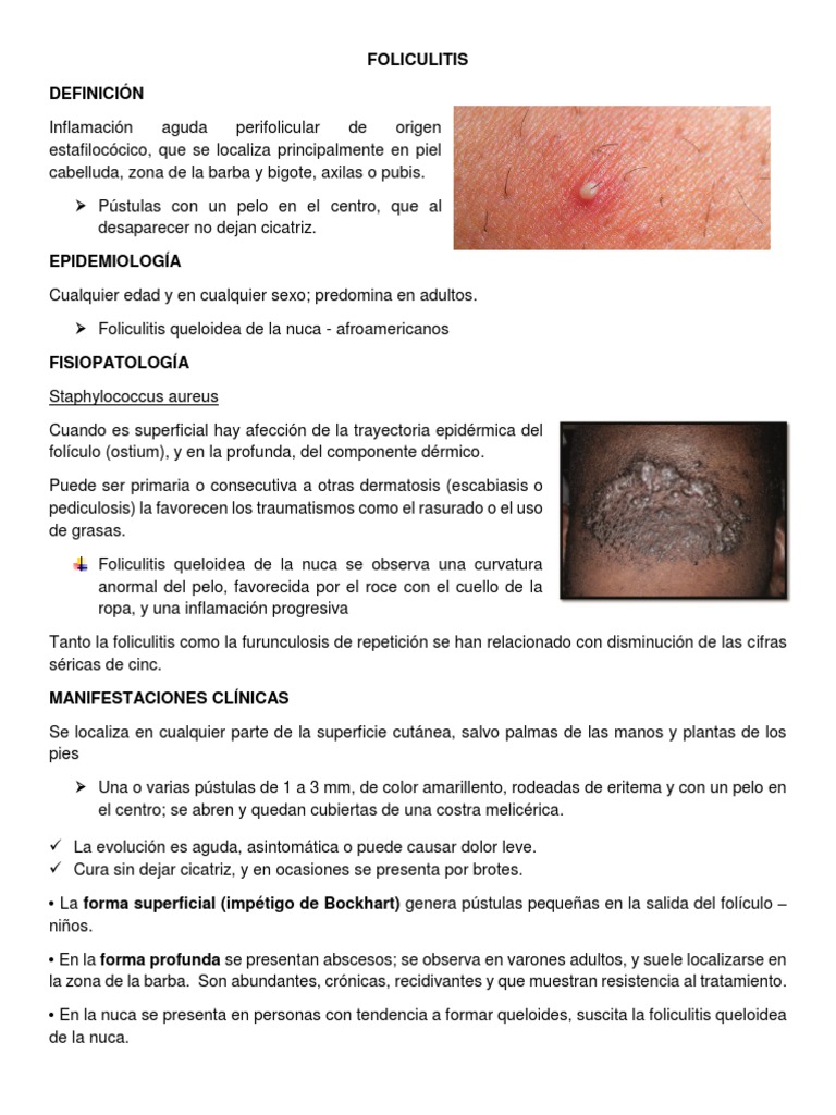 Tratamiento de la Foliculitis Genital y Axilar | PDF | Pelo ...