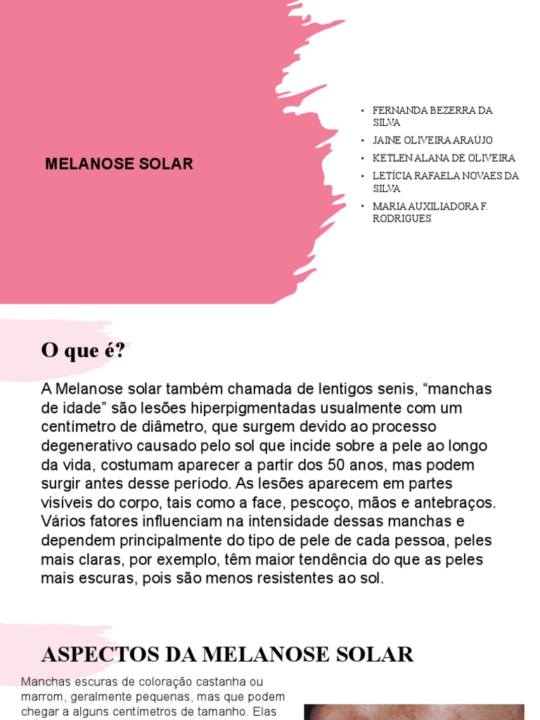 Melanose Solar | PDF | Protetor solar | Pele