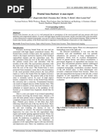 Abstrak PIT Hematosinus | PDF | Medical Emergencies | Surgical Specialties