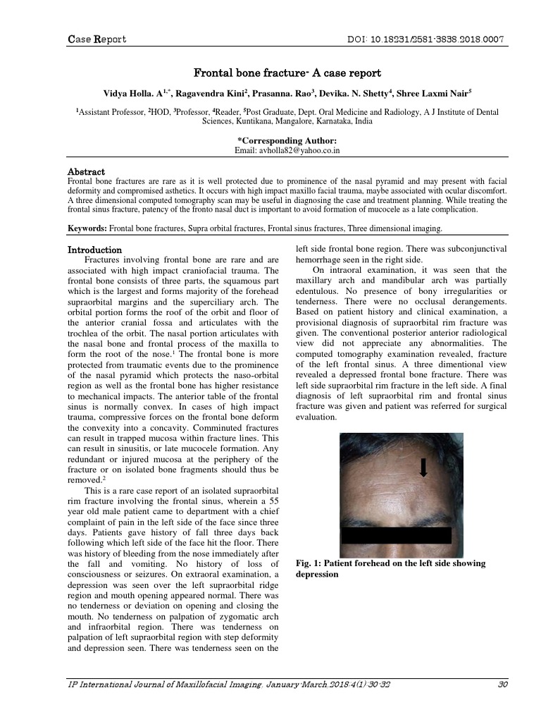 Frontal Bone Fracture Case Study | PDF | Human Nose | Skeletal System