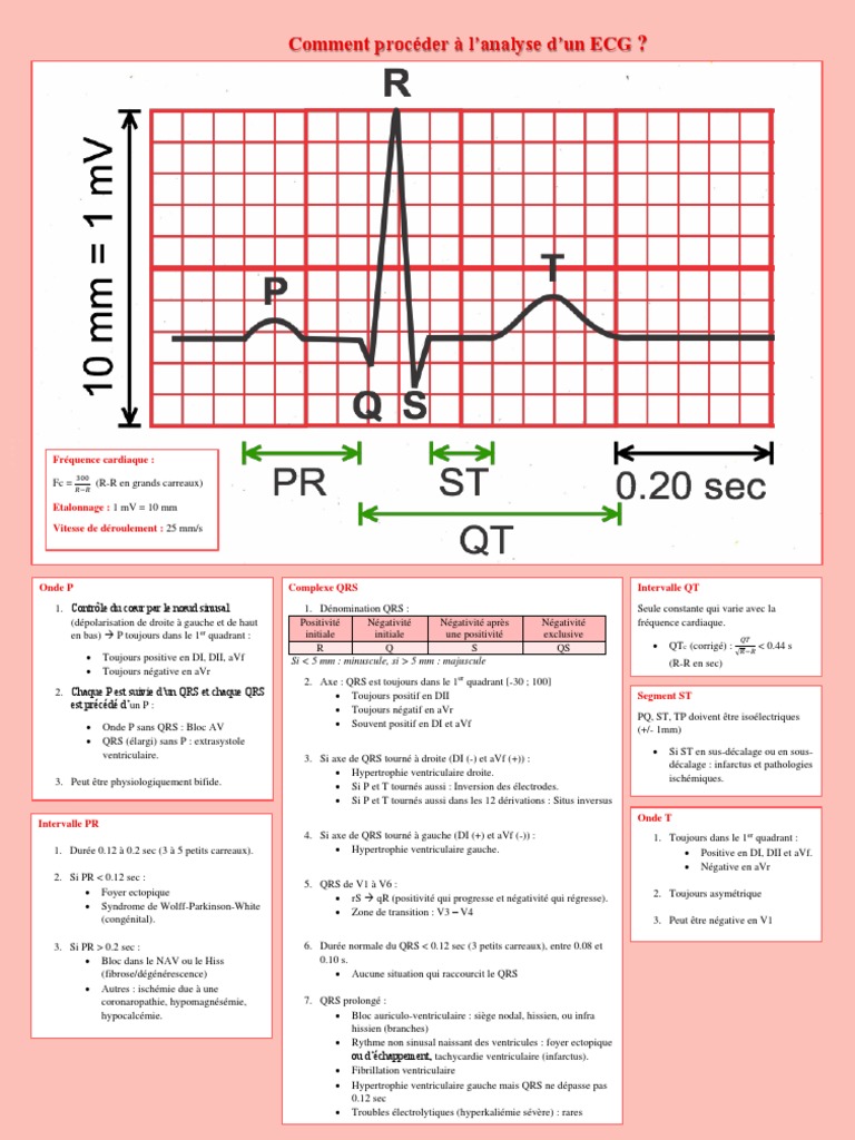 ECG Recap PDF | PDF | Électrophysiologie | Électrocardiographie