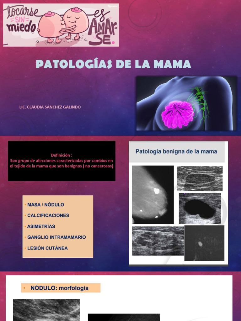 Enfermedades de La Mama | PDF | Cáncer de mama | Pecho