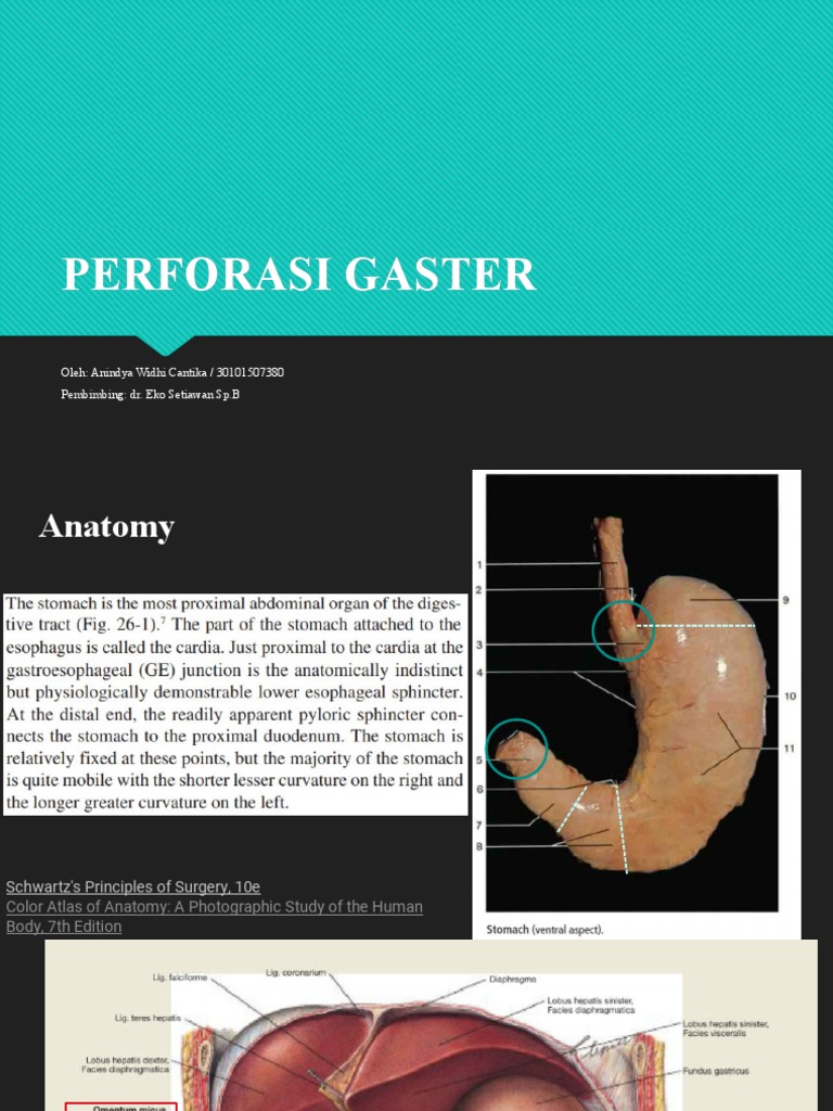 Gastric Perforation Overview | PDF | Clinical Medicine | Surgery