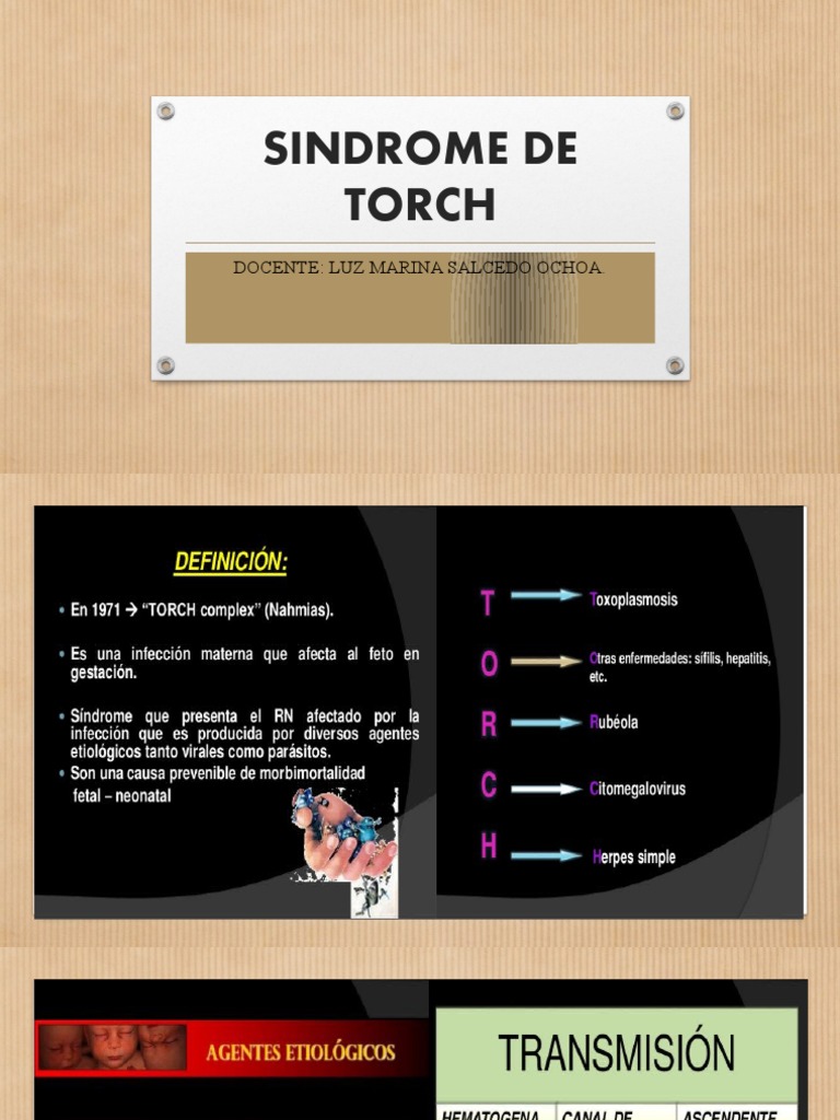 Sindrome de Torch | PDF