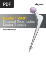 015 Exeter V40 Femoral Stem Using Modular Broach Surgical Technique For ...