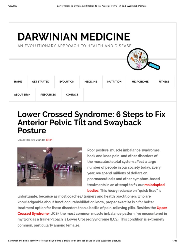 Lower Crossed Syndrome - 6 Steps To Fix Anterior Pelvic Tilt and ...