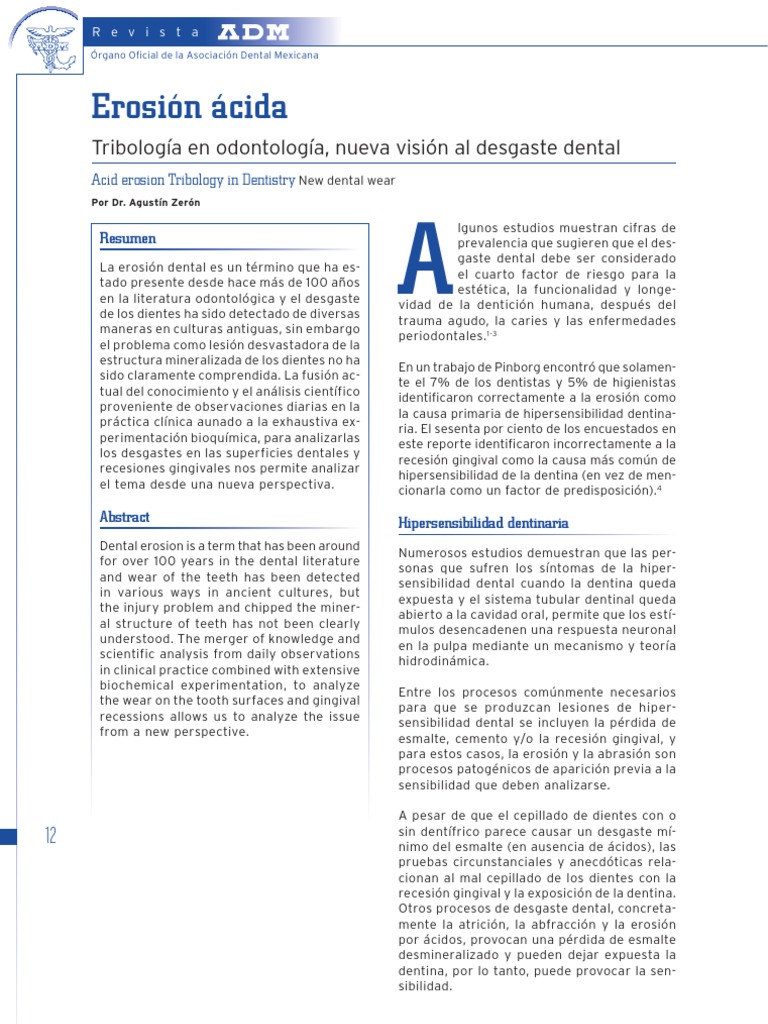 Erosión Ácida y Desgaste Dental: Análisis | PDF | Diente | Odontología