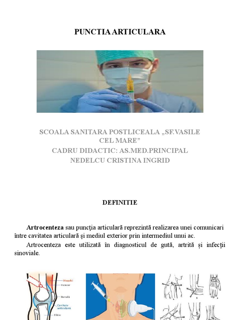 9.punctia Articulara | PDF